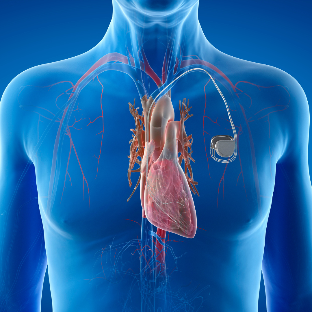 News Monash Heart Private